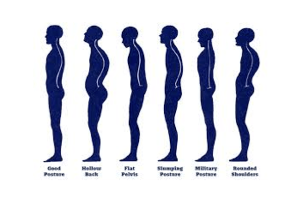 Posture & Osteoporosis Workshop: Building Better Bones - Owatonna ...